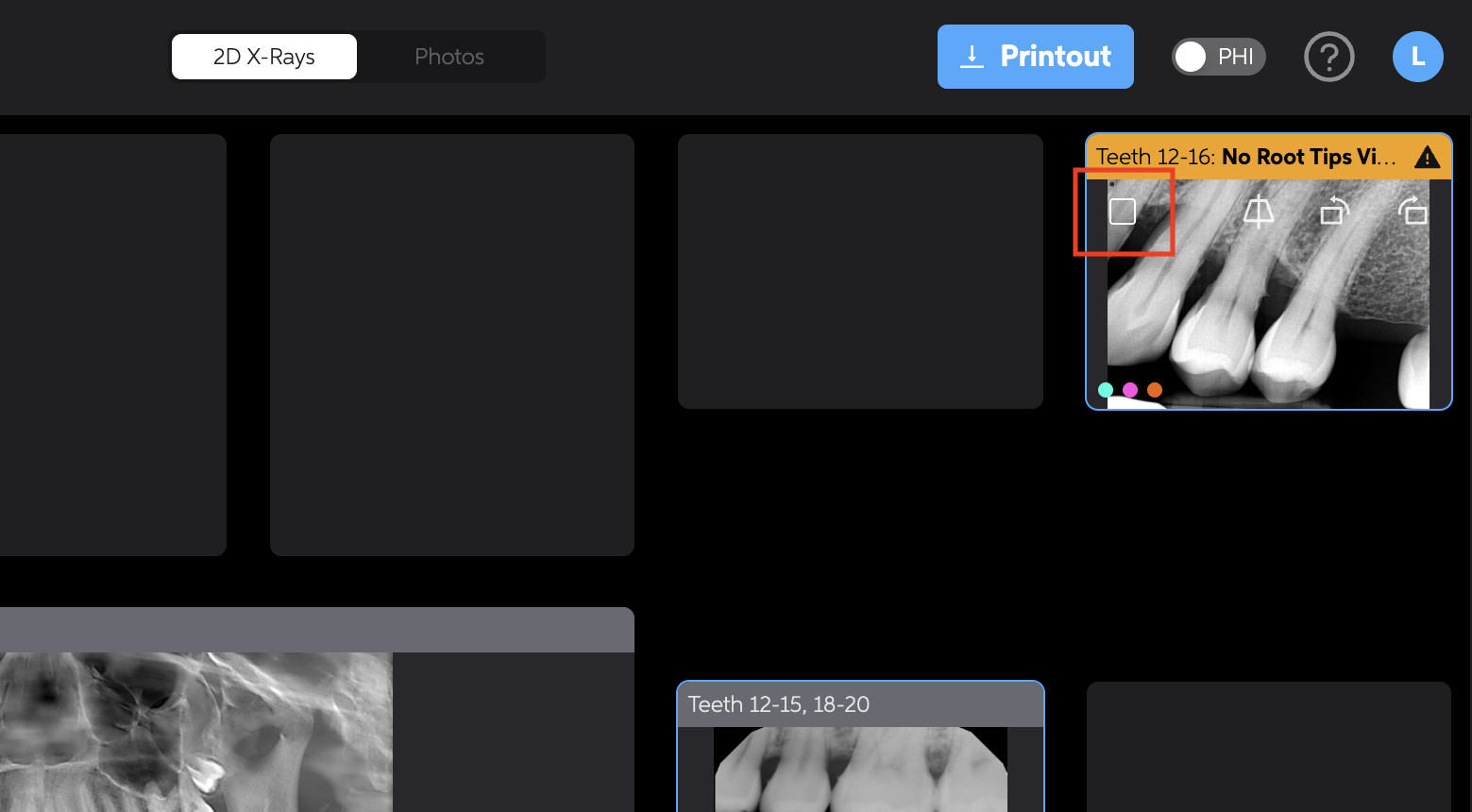 How to Delete Images in Second Opinion